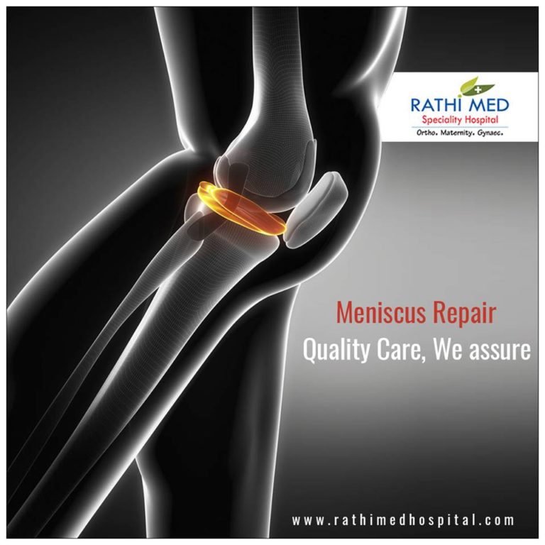 Meniscus Repair Treatment Chennai | Meniscus Repair Surgery India